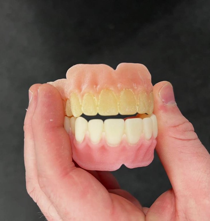 NextDent 300 - Material Bottle Rolling Guidance